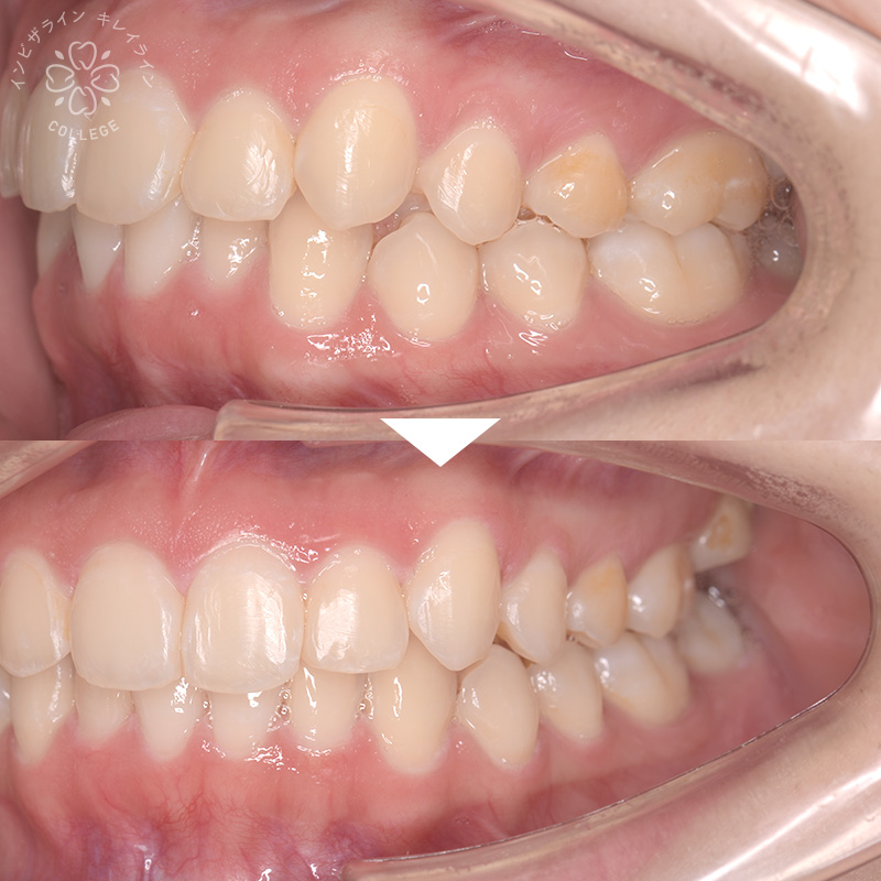 症例｜Page-2｜インビザキレイラインカレッジ