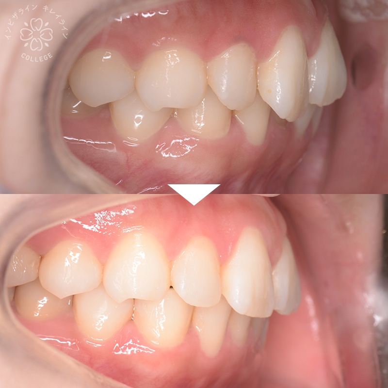 症例｜Page-2｜インビザキレイラインカレッジ